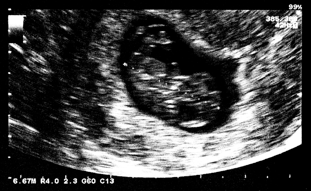 7. grūtniecības nedēļa – grūtniecības kalendārs | Mammamuntetiem.lv