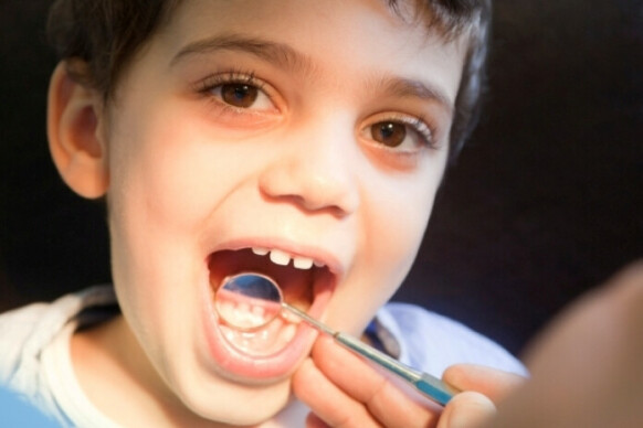 Jaunākās tendences zobu aizsardzībai no kariesa – silanti ...